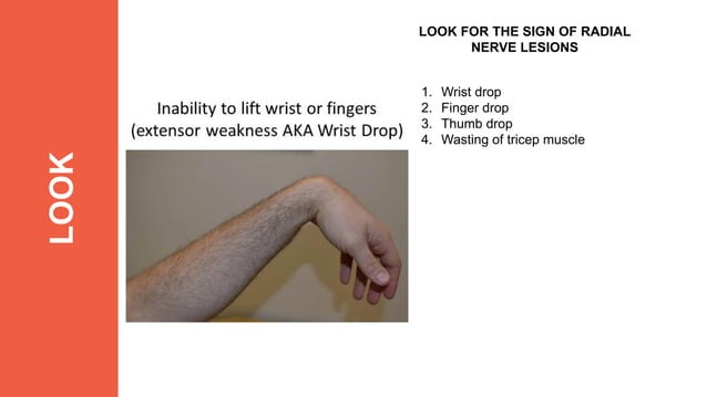 Peripheral nerve examination of upper limb.pptx