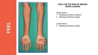 Peripheral nerve examination of upper limb.pptx
