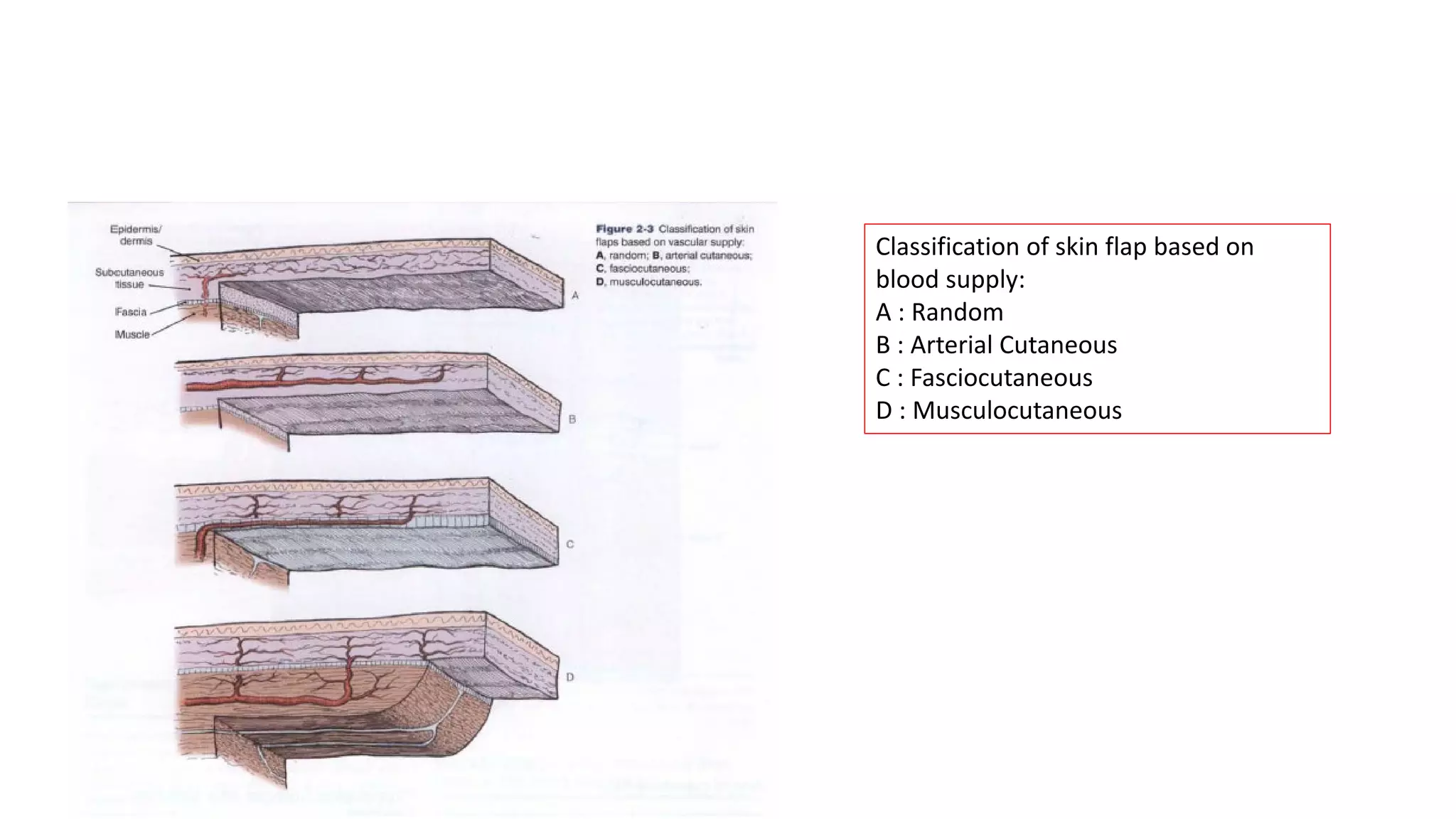 Basic Principles of Flap | PDF