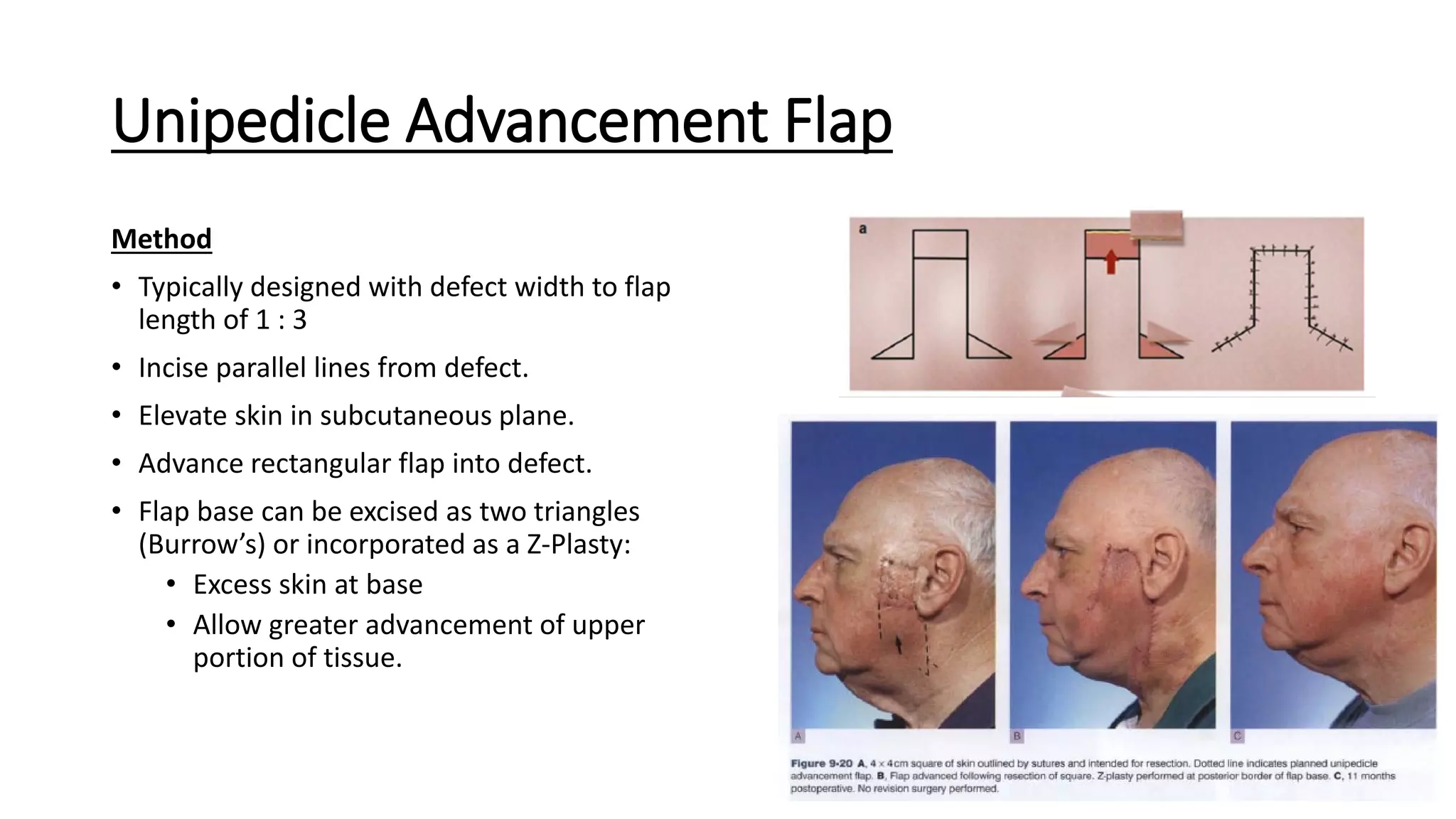 Basic Principles of Flap | PDF