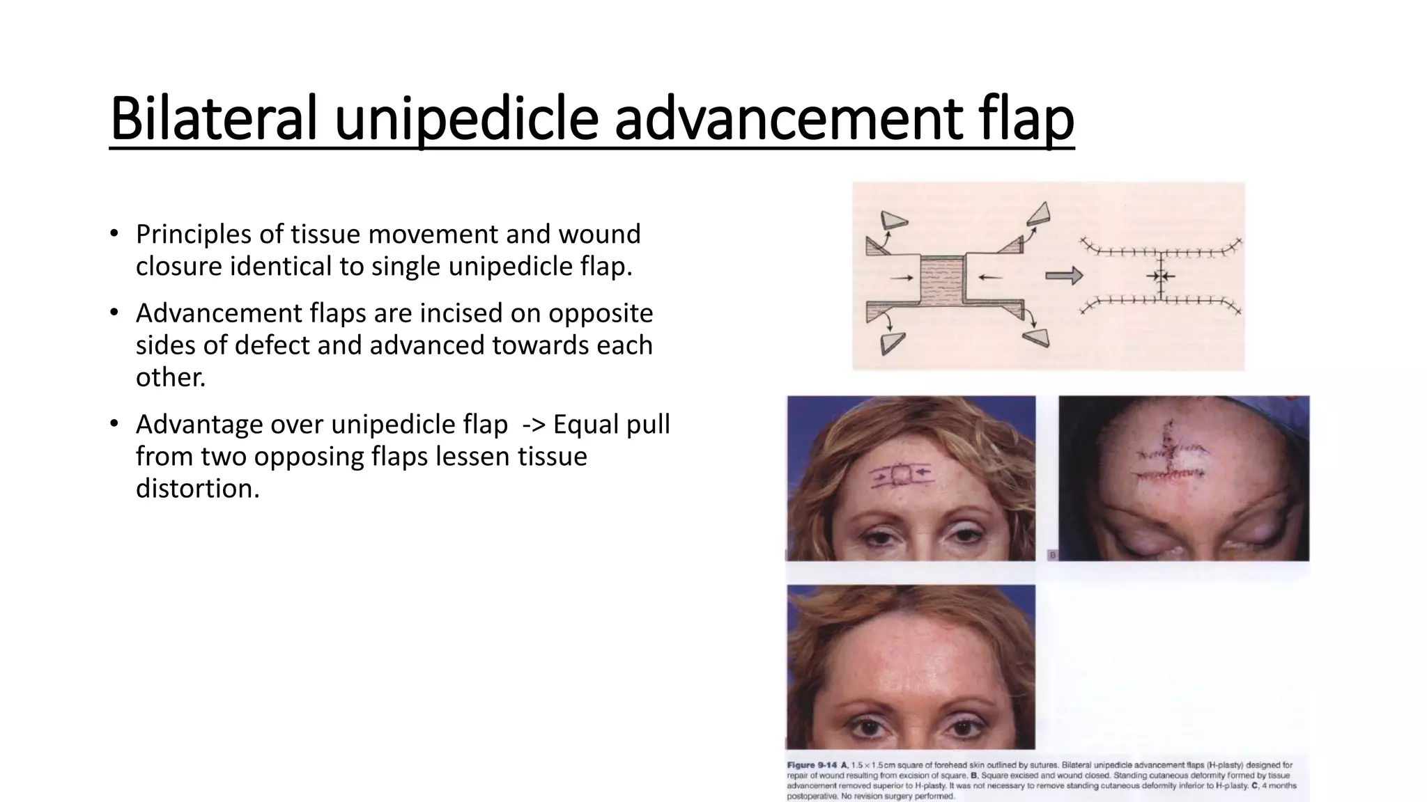 Basic Principles of Flap | PDF
