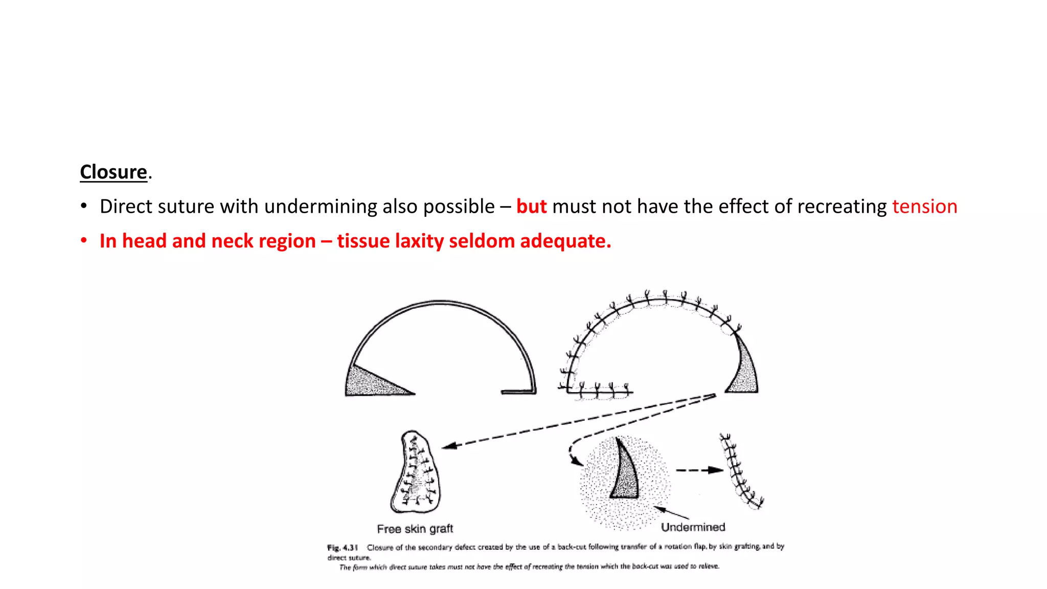 Basic Principles of Flap | PDF
