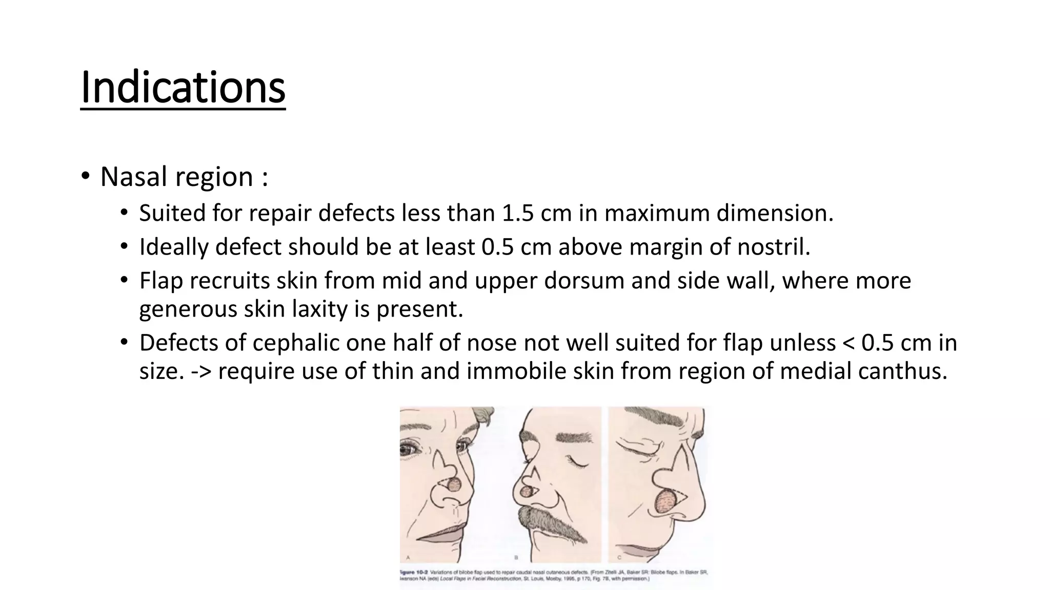 Basic Principles of Flap | PDF