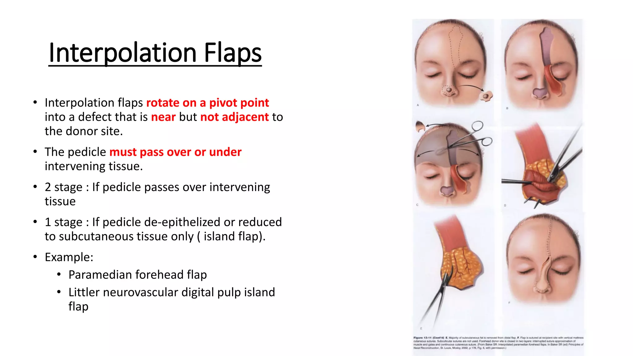 Basic Principles of Flap | PDF