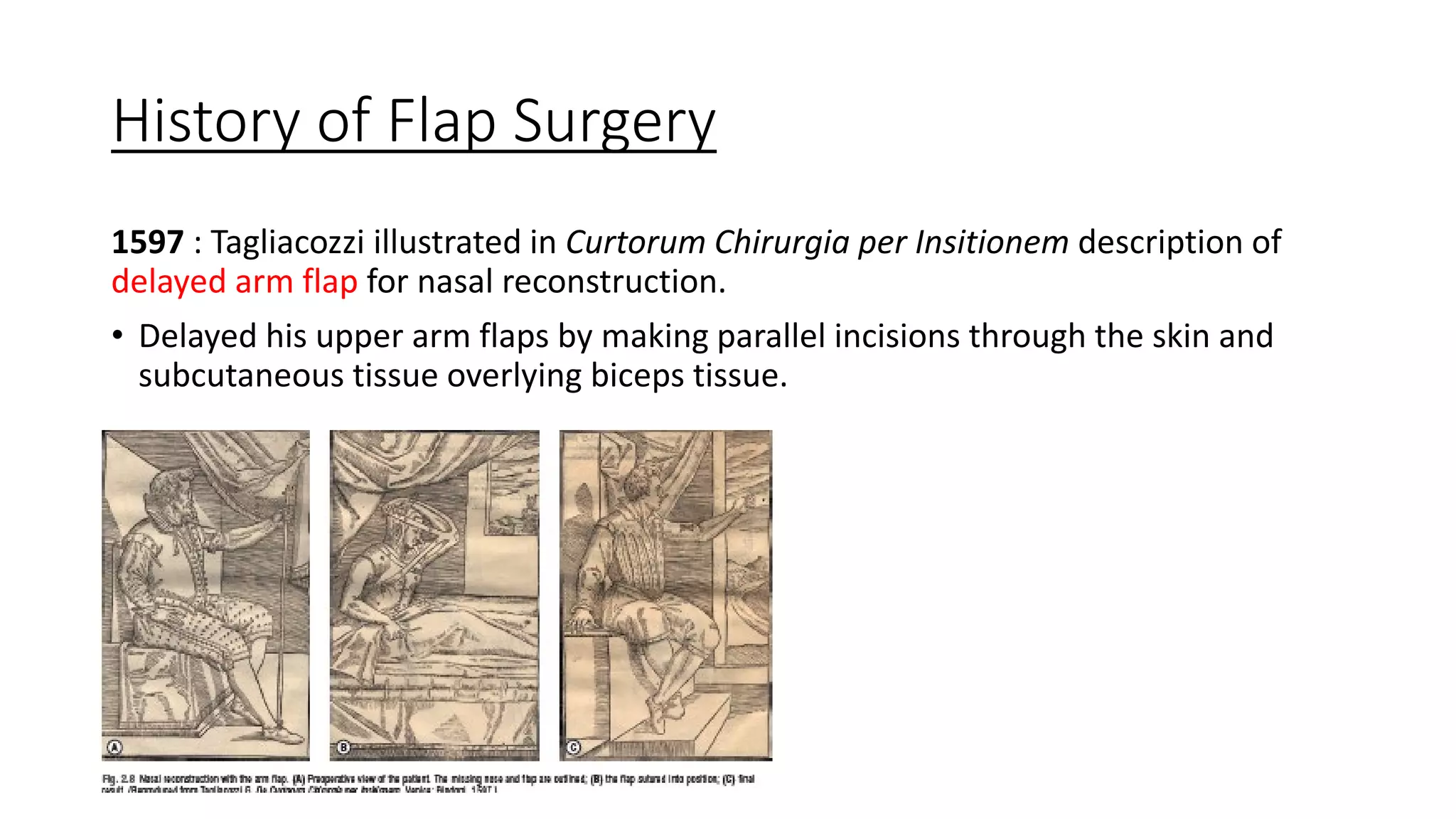 Basic Principles of Flap | PDF