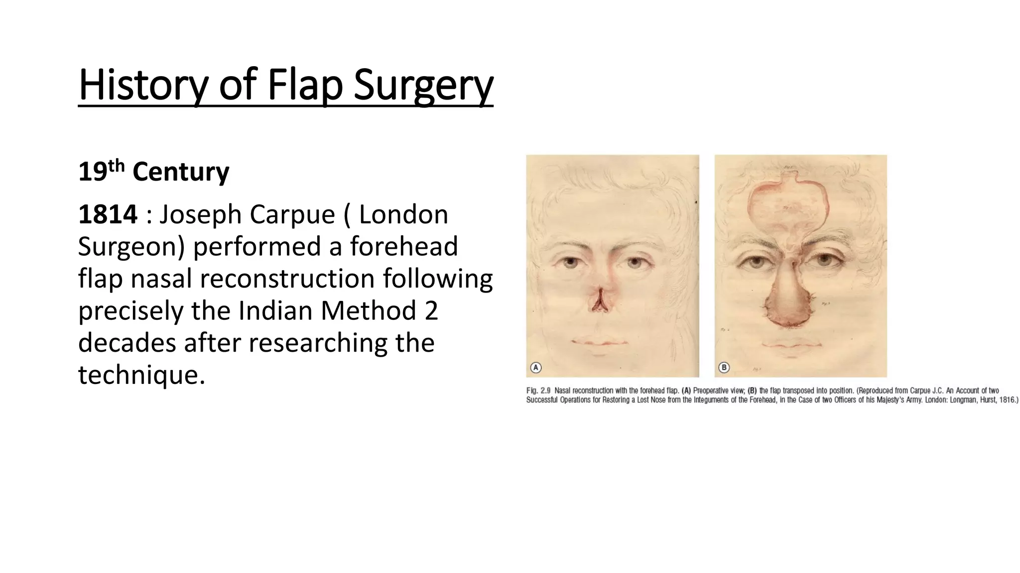 Basic Principles of Flap | PDF