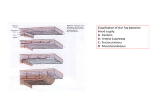Basic Principles of Flap | PDF