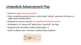 Basic Principles of Flap | PDF