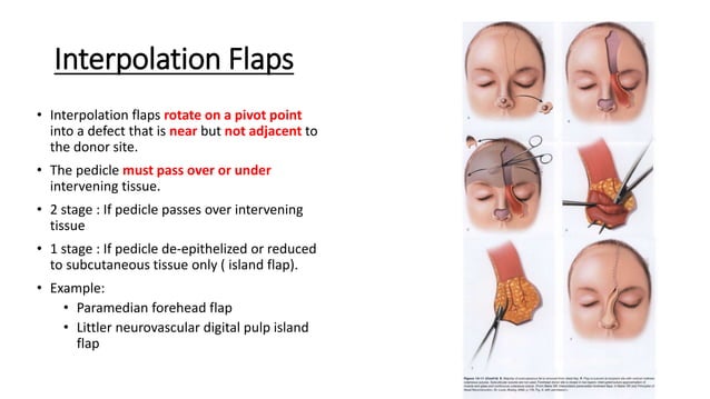 Basic Principles of Flap | PDF | Cosmetic Medical Services | Medical Health