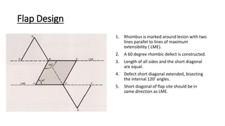 Basic Principles of Flap | PDF