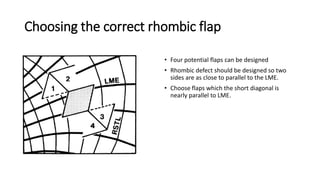 Basic Principles of Flap | PDF