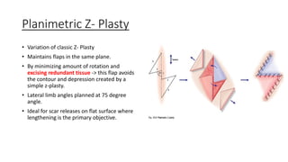 Basic Principles of Flap | PDF