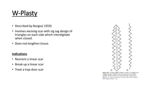 Basic Principles of Flap | PDF