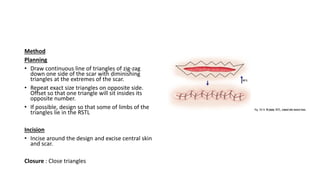 Basic Principles of Flap | PDF