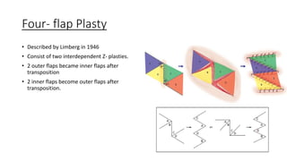 Basic Principles Of Flap Pdf