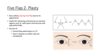 Basic Principles of Flap | PDF