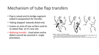 Basic Principles of Flap | PDF