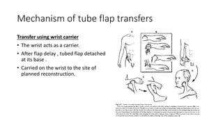Basic Principles of Flap | PDF | Cosmetic Medical Services | Medical Health