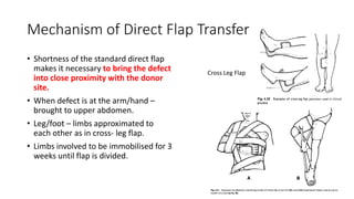 Basic Principles of Flap | PDF