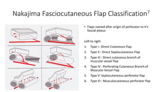 Basic Principles of Flap | PDF