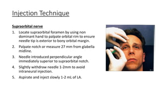 Local anaesthesia and facial block | PDF