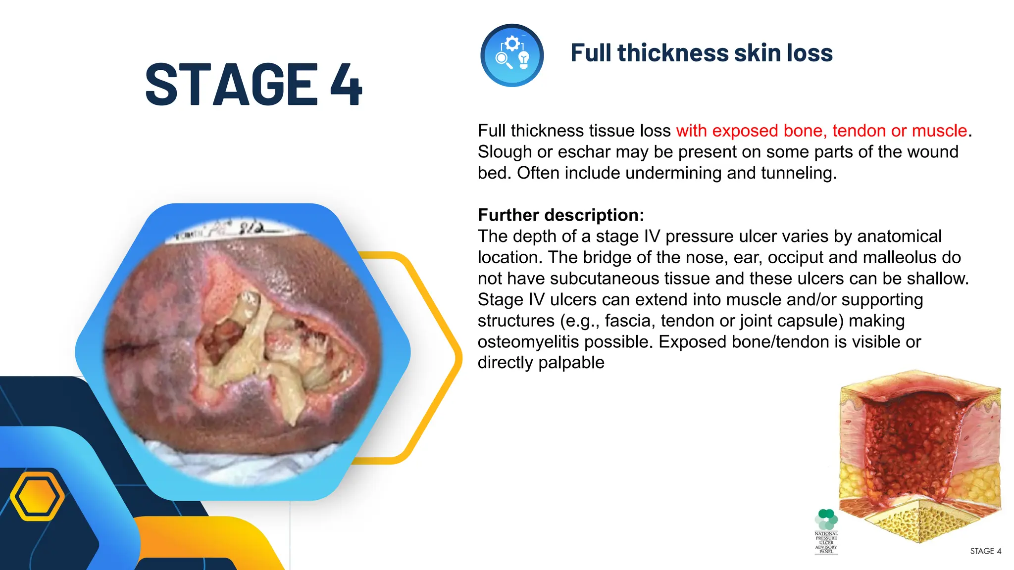 PRESSURE INJURY CARE AND MANAGEMENT FOR HCW | PDF