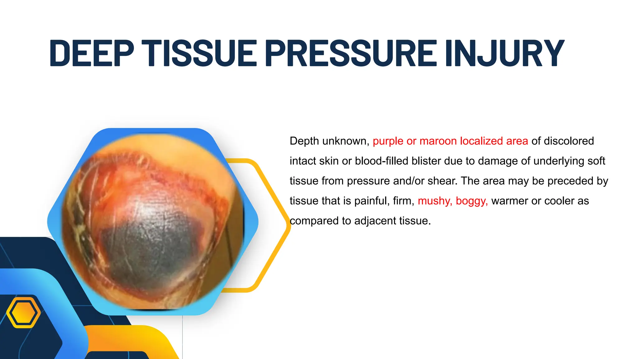 PRESSURE INJURY CARE AND MANAGEMENT FOR HCW | PDF
