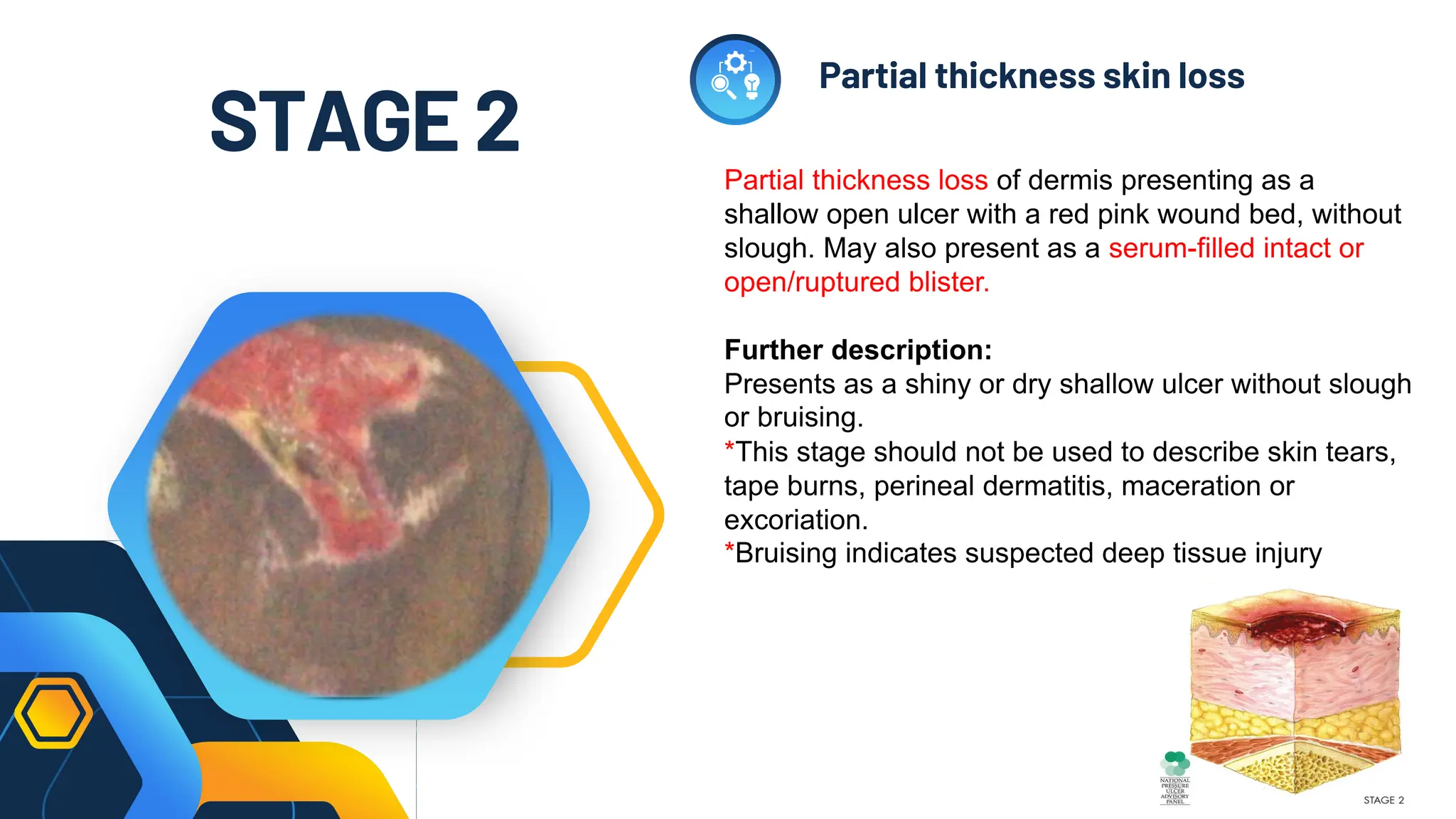 PRESSURE INJURY CARE AND MANAGEMENT FOR HCW | PDF