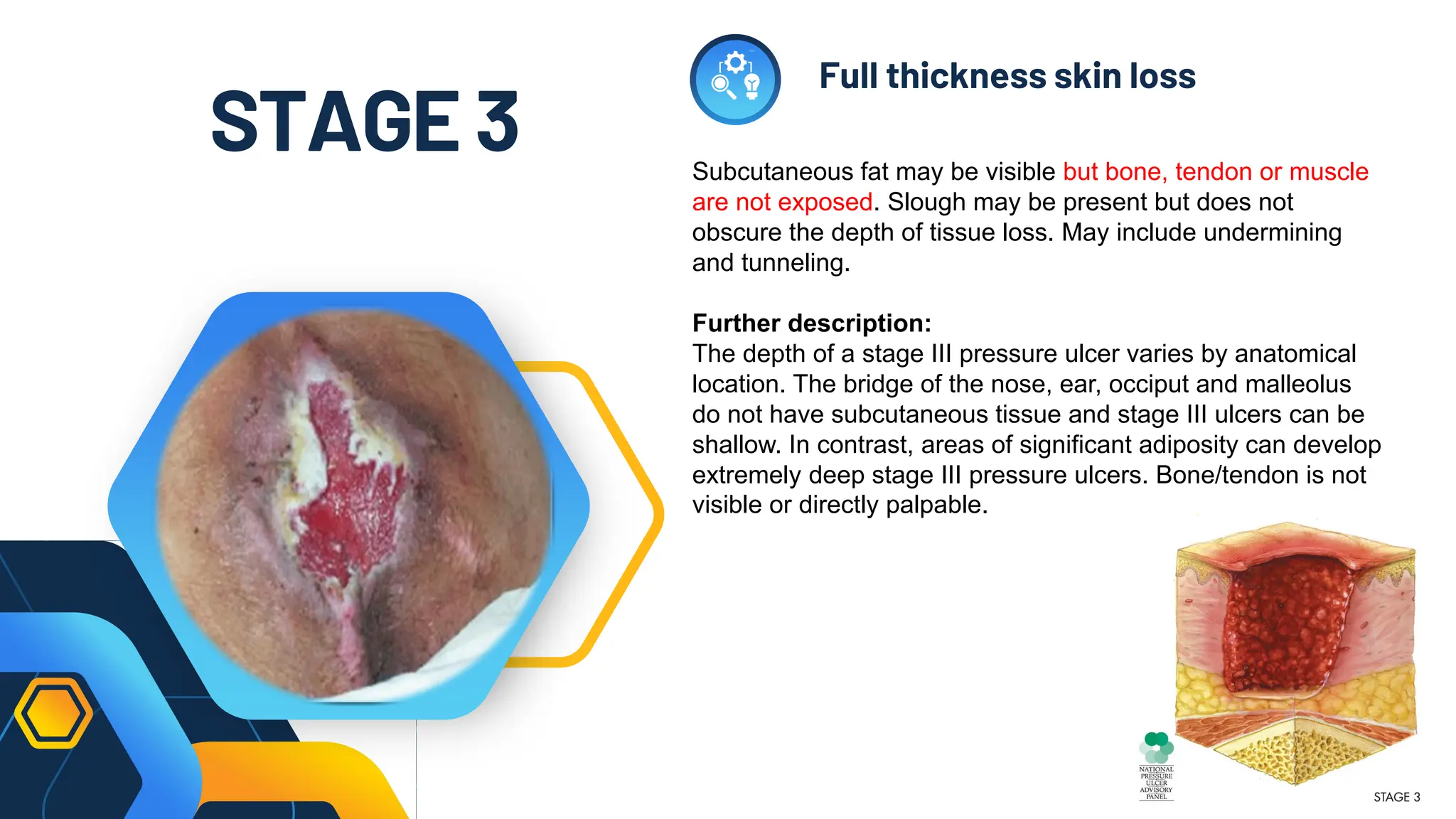 PRESSURE INJURY CARE AND MANAGEMENT FOR HCW | PDF