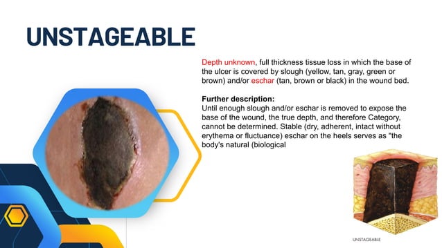 PRESSURE INJURY CARE AND MANAGEMENT FOR HCW | PDF | First Aid | Injuries