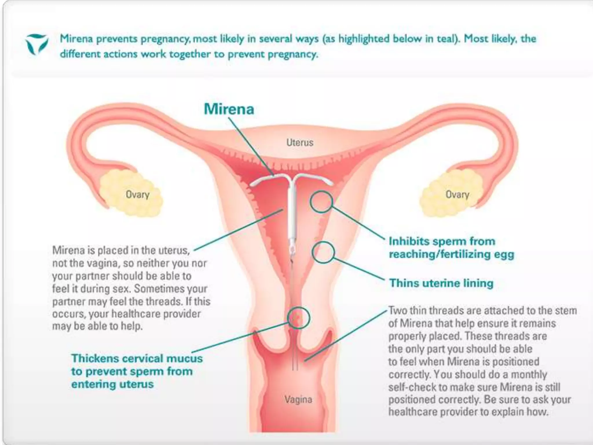 CME PRESENTATION LSC ONG.pptx