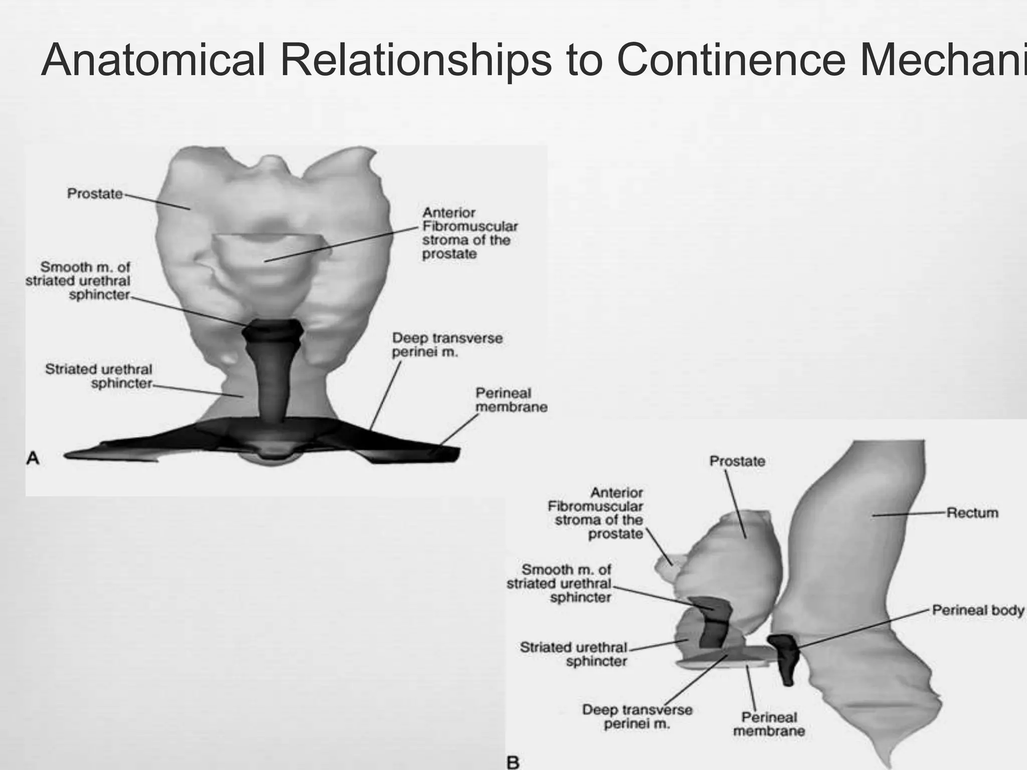 Prostate - Clinical Anatomy as applied to Prostate Cancer | PPTX