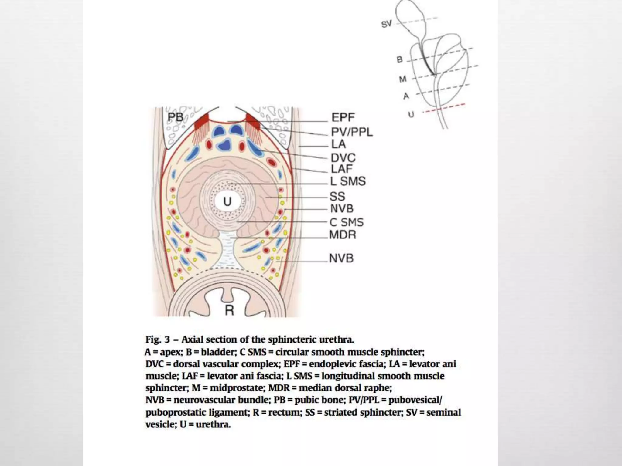 Prostate - Clinical Anatomy as applied to Prostate Cancer | PPTX