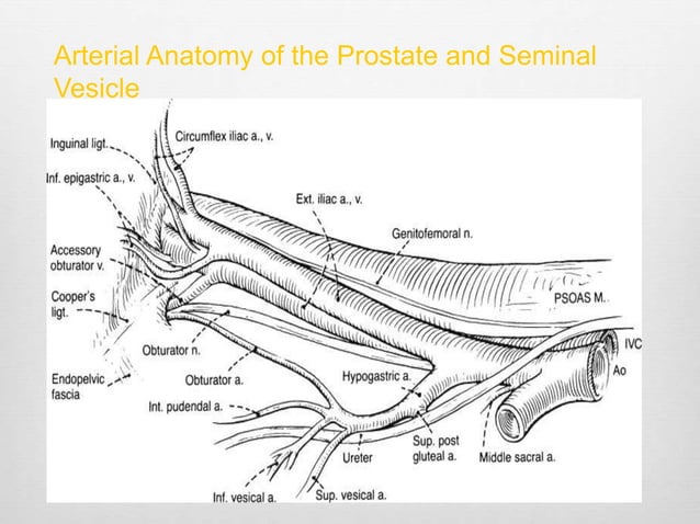 Prostate - Clinical Anatomy as applied to Prostate Cancer | PPTX ...