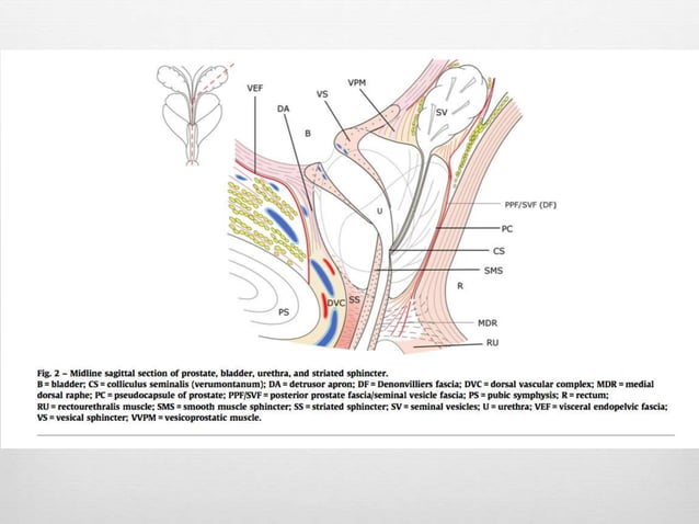 Prostate - Clinical Anatomy as applied to Prostate Cancer | PPTX ...
