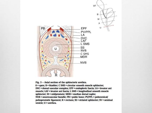 Prostate - Clinical Anatomy as applied to Prostate Cancer | PPTX ...
