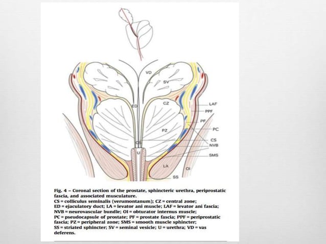 Prostate - Clinical Anatomy as applied to Prostate Cancer | PPTX ...