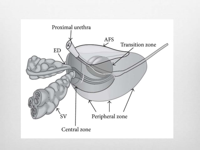 Prostate - Clinical Anatomy as applied to Prostate Cancer | PPTX ...