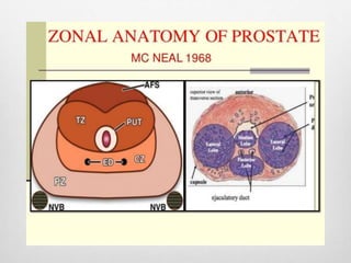 Prostate - Clinical Anatomy as applied to Prostate Cancer | PPTX