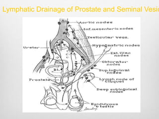 Prostate - Clinical Anatomy as applied to Prostate Cancer | PPT