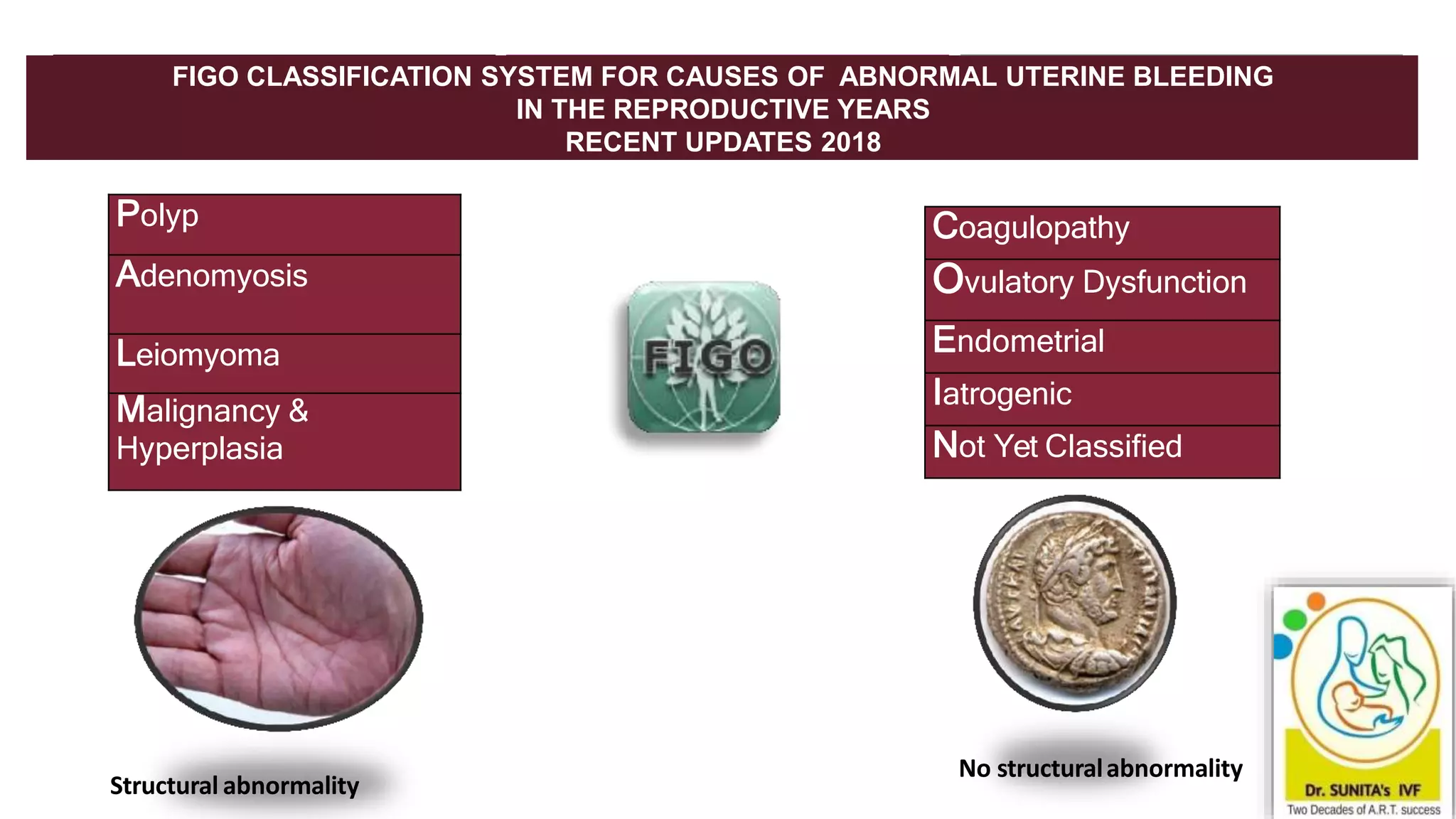 ABNORMAL UTERINE BLEEDING- WHAT IS NEW ? | PPT