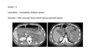 CME splenic injury.pptx