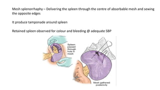 CME splenic injury.pptx