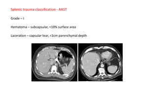 CME splenic injury.pptx