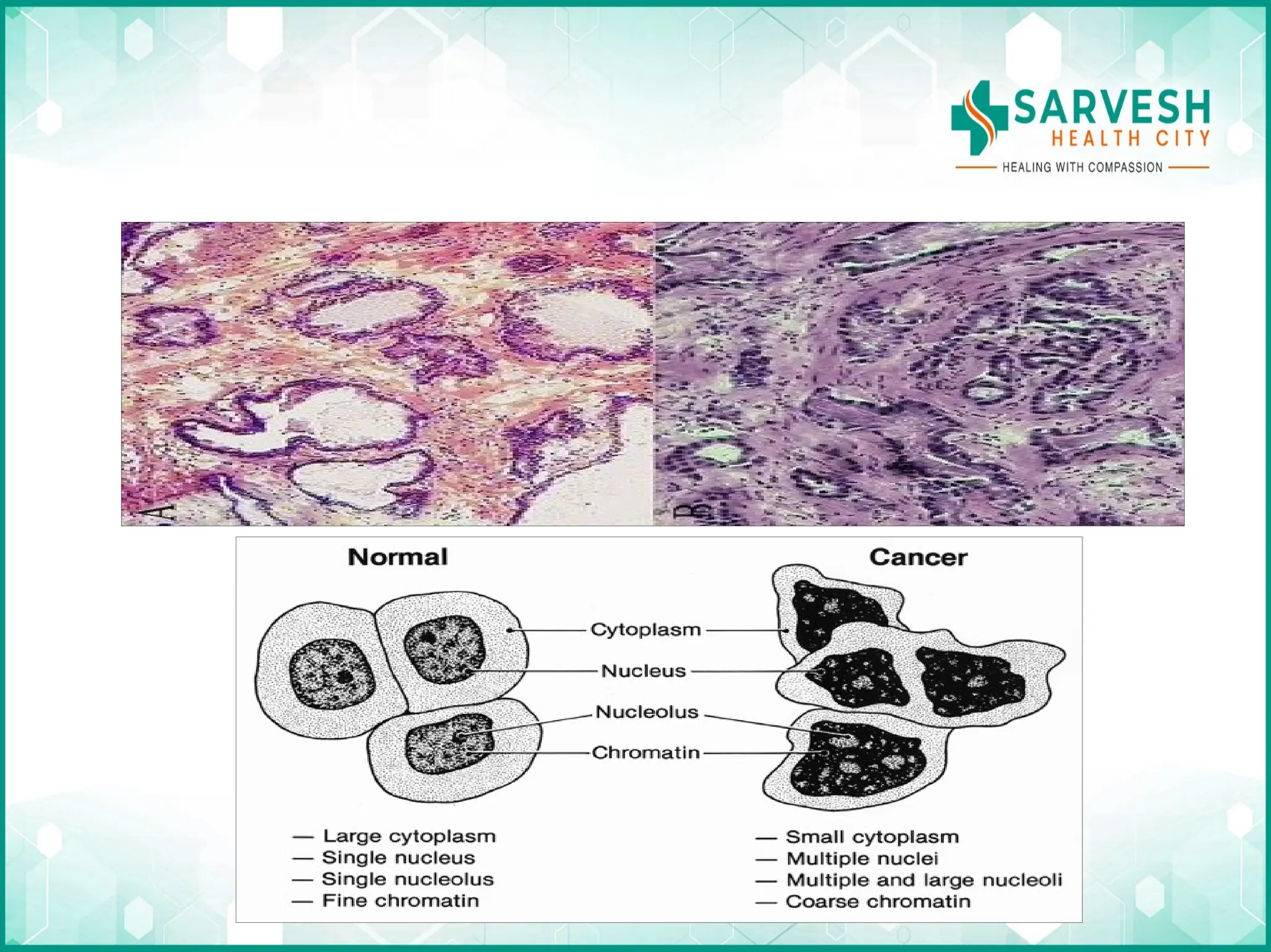 Basics of surgical oncology and pathophysiology of cancer.pptx