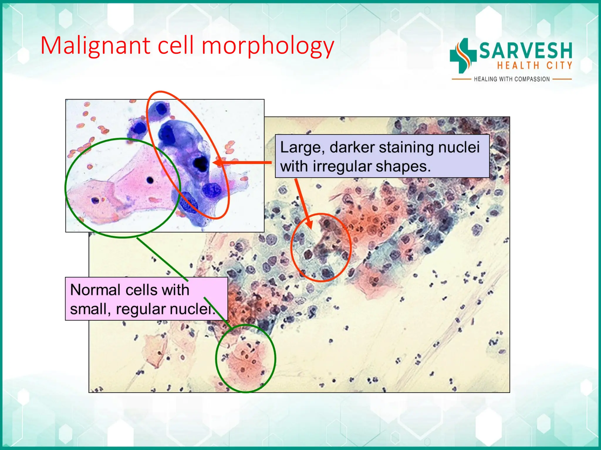 Basics of surgical oncology and pathophysiology of cancer.pptx