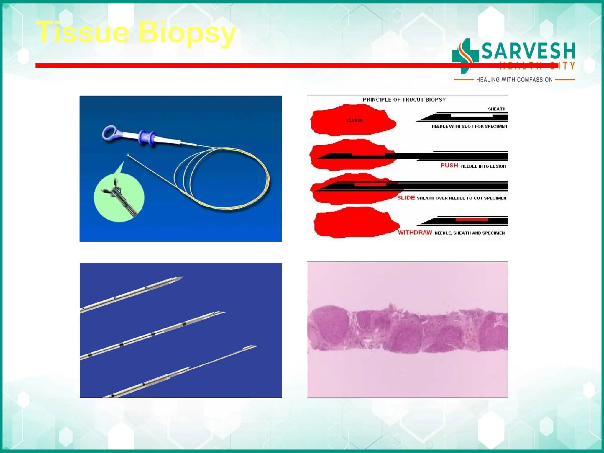 Basics of surgical oncology and pathophysiology of cancer.pptx