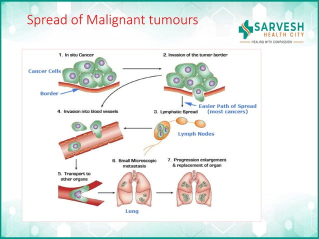Basics of surgical oncology and pathophysiology of cancer.pptx | Free ...