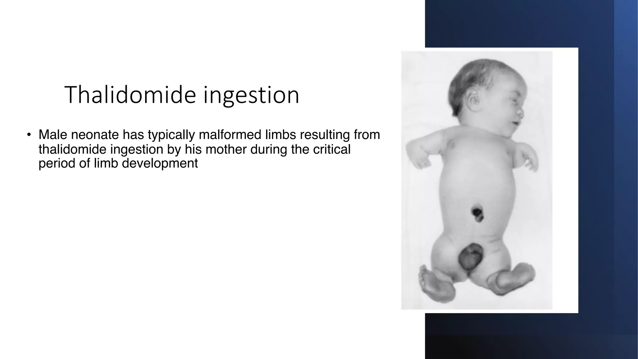 Human Birth Defects and Common congenital anomalies | PDF