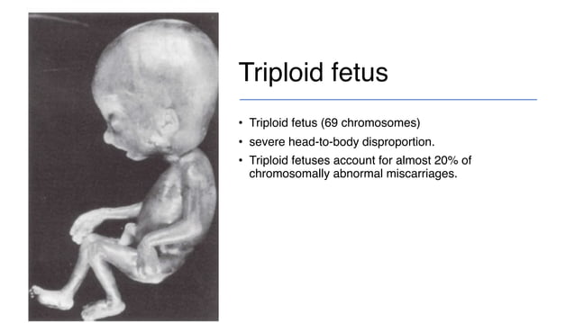 Human Birth Defects and Common congenital anomalies | PDF | Pregnancy ...